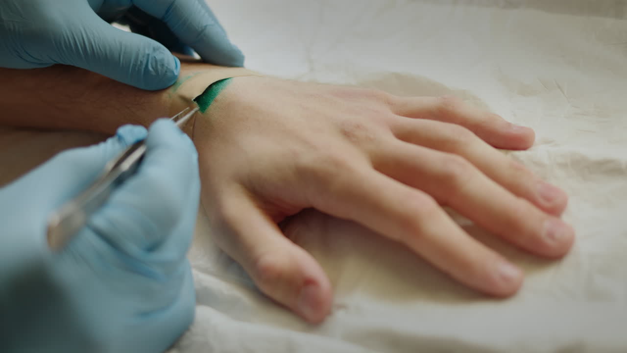 Premium stock video - Stitches removed from a wound